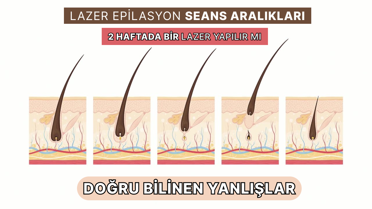 Lazer Epilasyon Seans Aralıkları & 2 Haftada Bir Lazer Yapılır Mı ...
